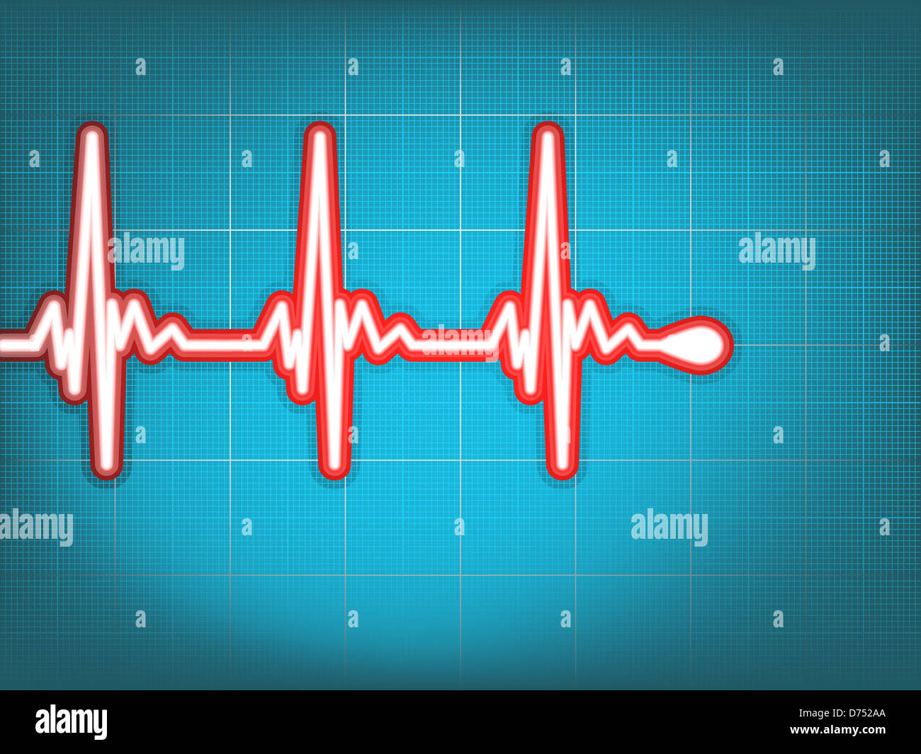 Heart cardiogram with shadow on light blue Stock Photo - Alamy