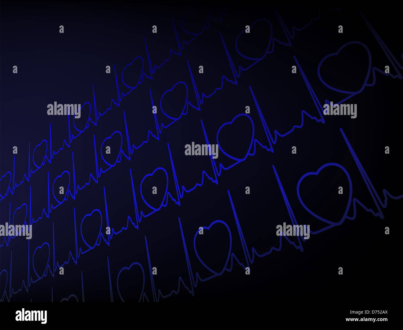 ECG tracing monitor Stock Photo - Alamy