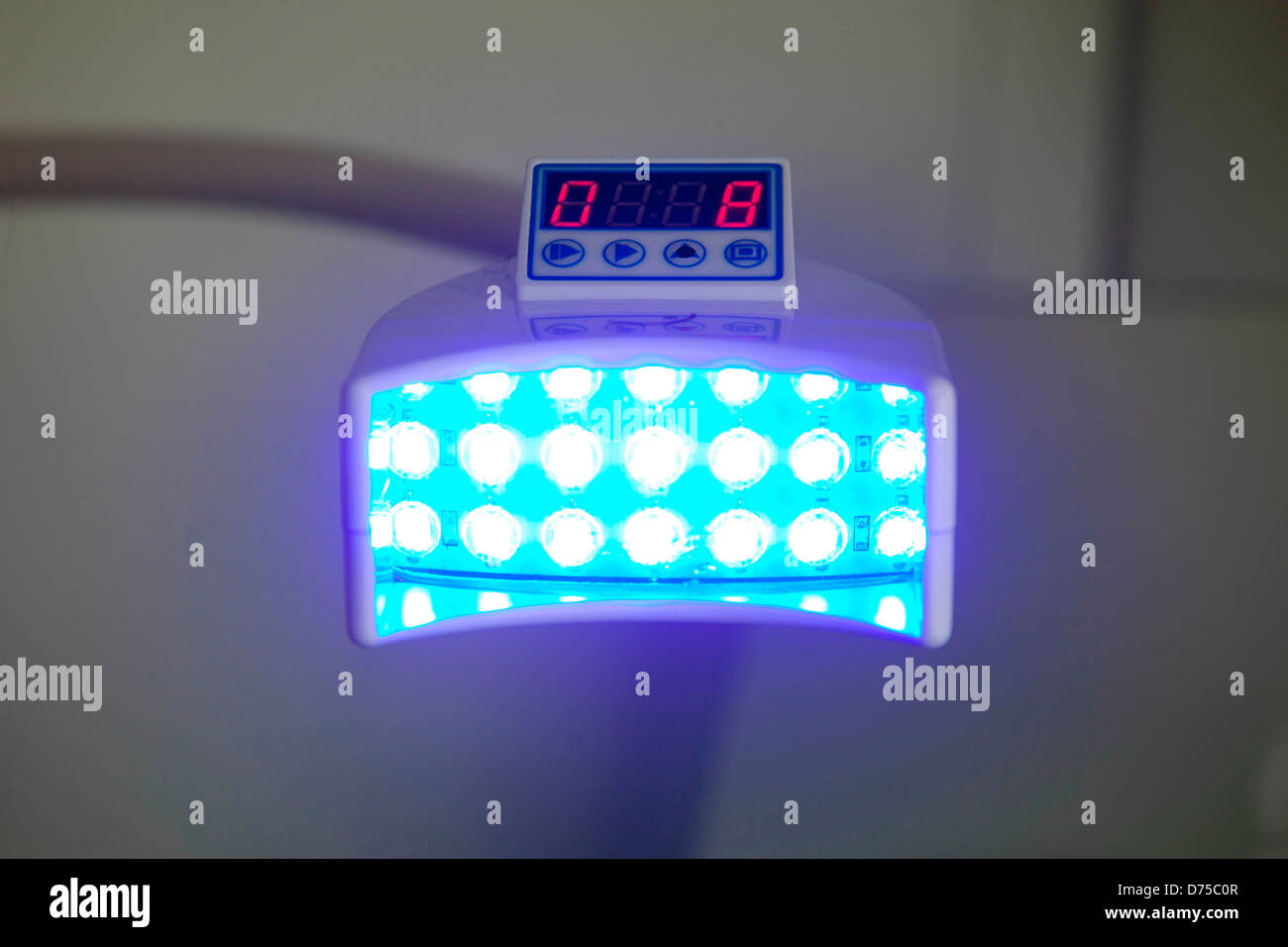 Smile bar Teeth whitening by applying gel active product placed in ...