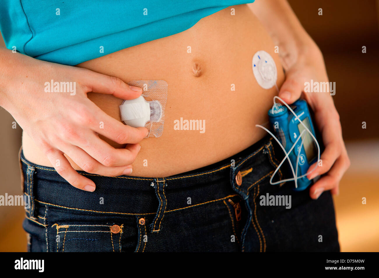 Insulin Pump High Resolution Stock Photography and Images - Alamy