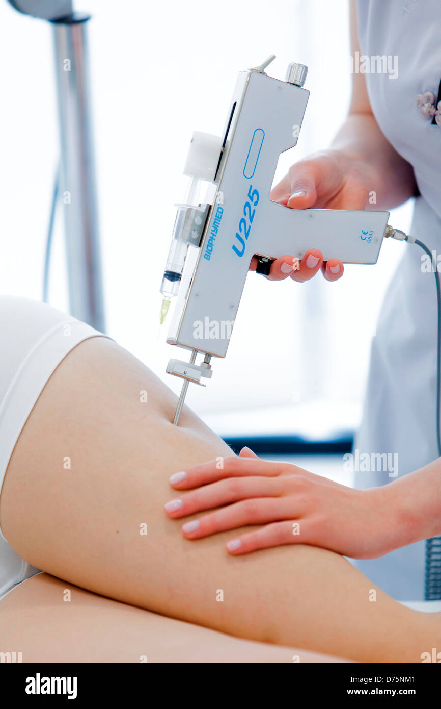 Mesotherapy by injection used in the cellulite treatment Stock Photo ...