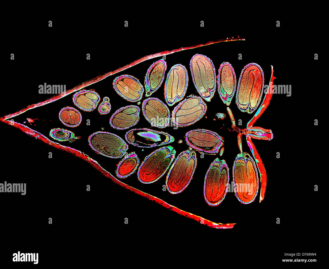 Capsella Schefflera embryo in ovary magnification imaged enhanced Stock ...