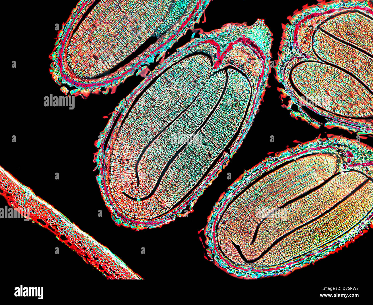Capsella Schefflera embryo in ovary magnification 40x imaged enhanced ...