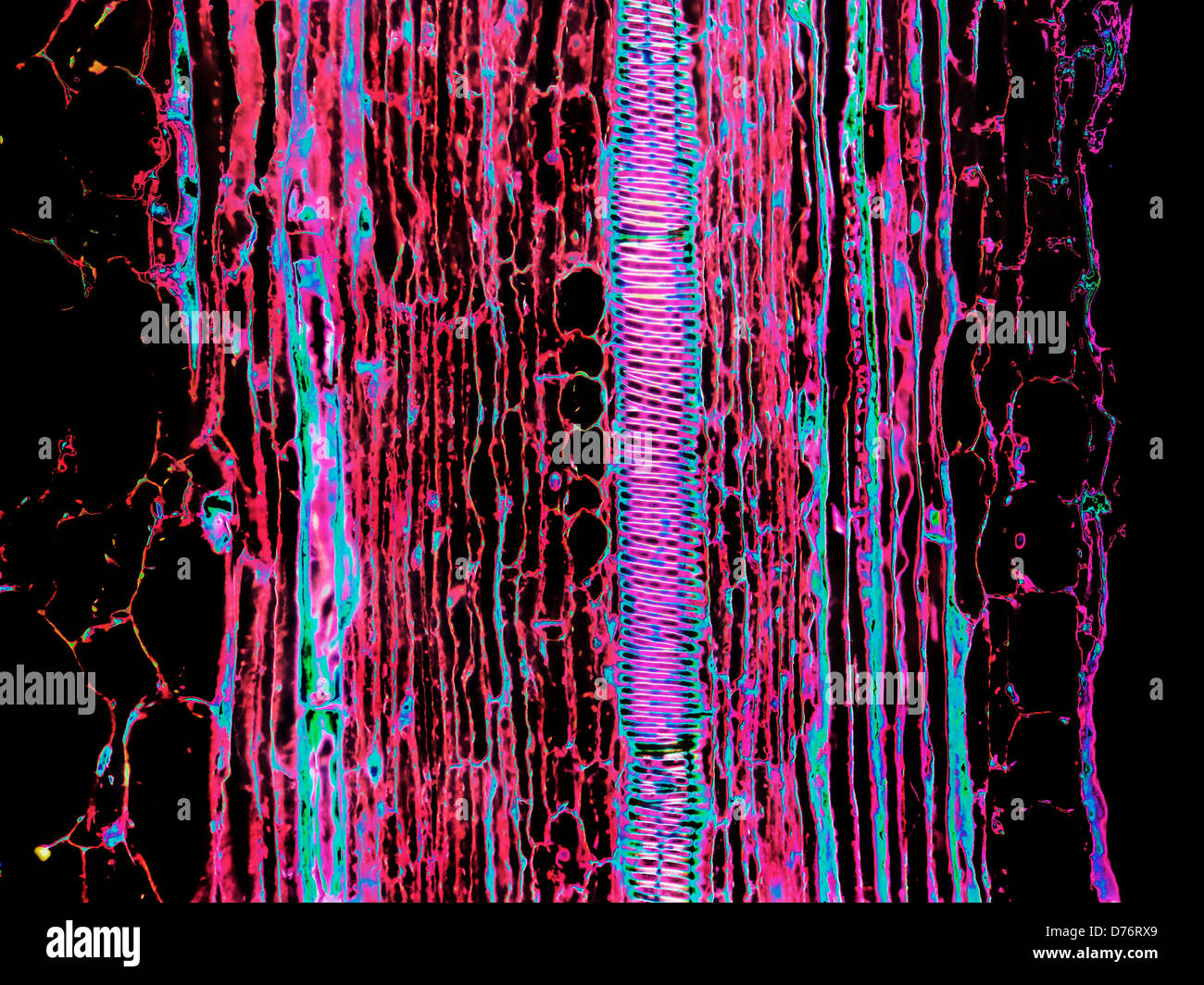 Stem Tracheids Fibers Vessels