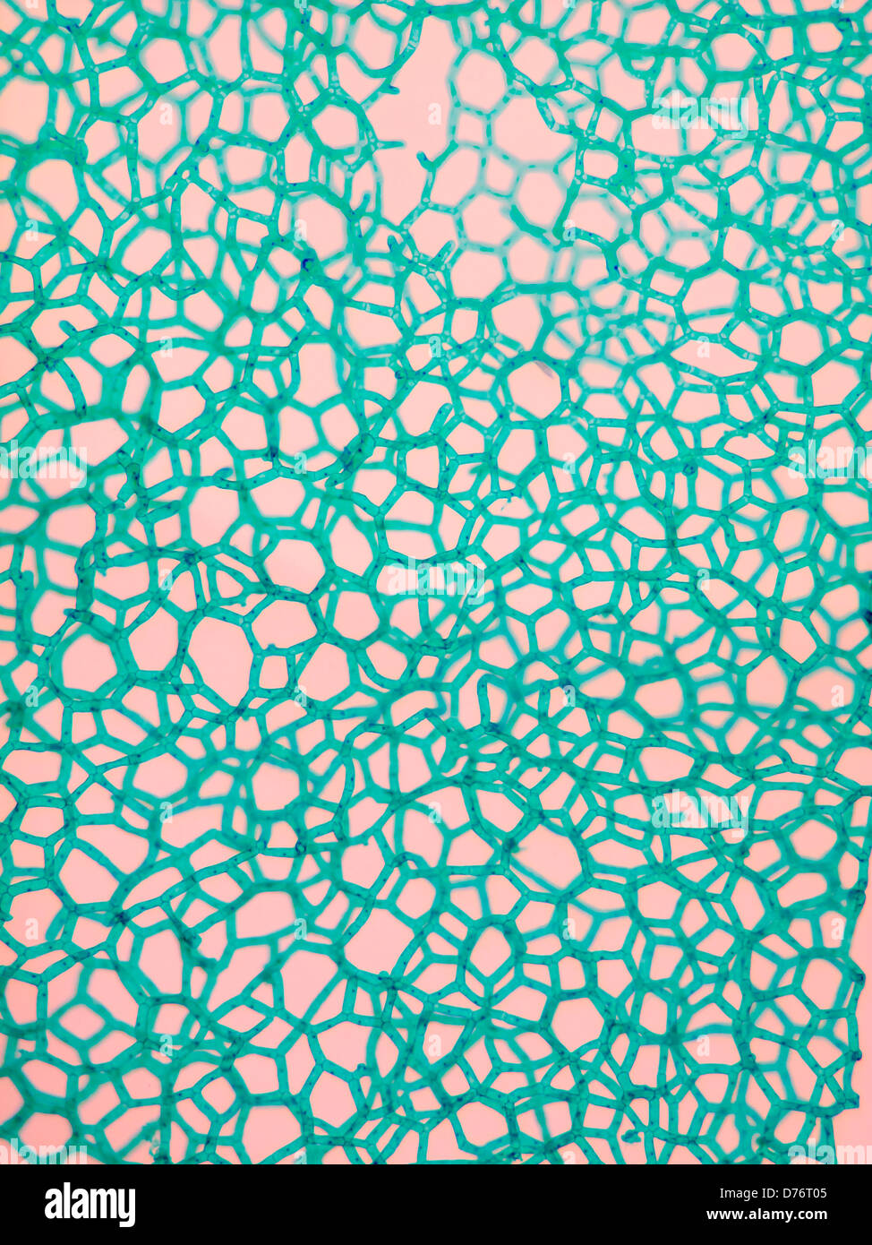 Hydrodictyon algae magnification 200x This algae has become pest on ...
