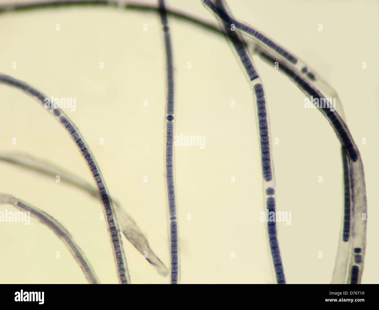 Lyngbya hi-res stock photography and images - Alamy