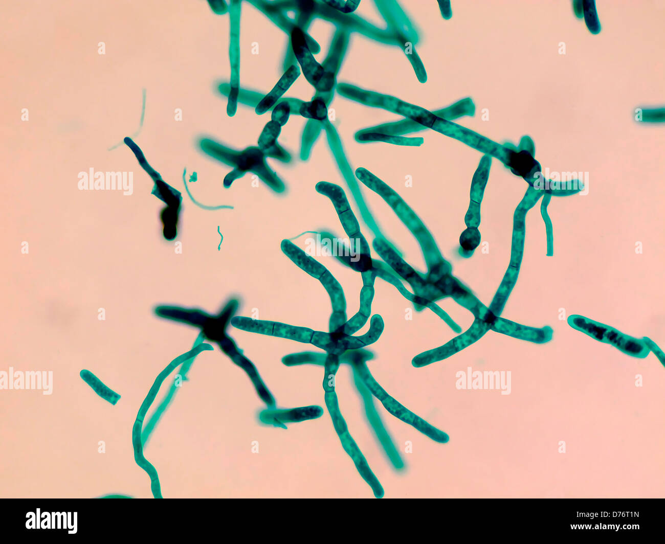 Moss Protonema Labeled