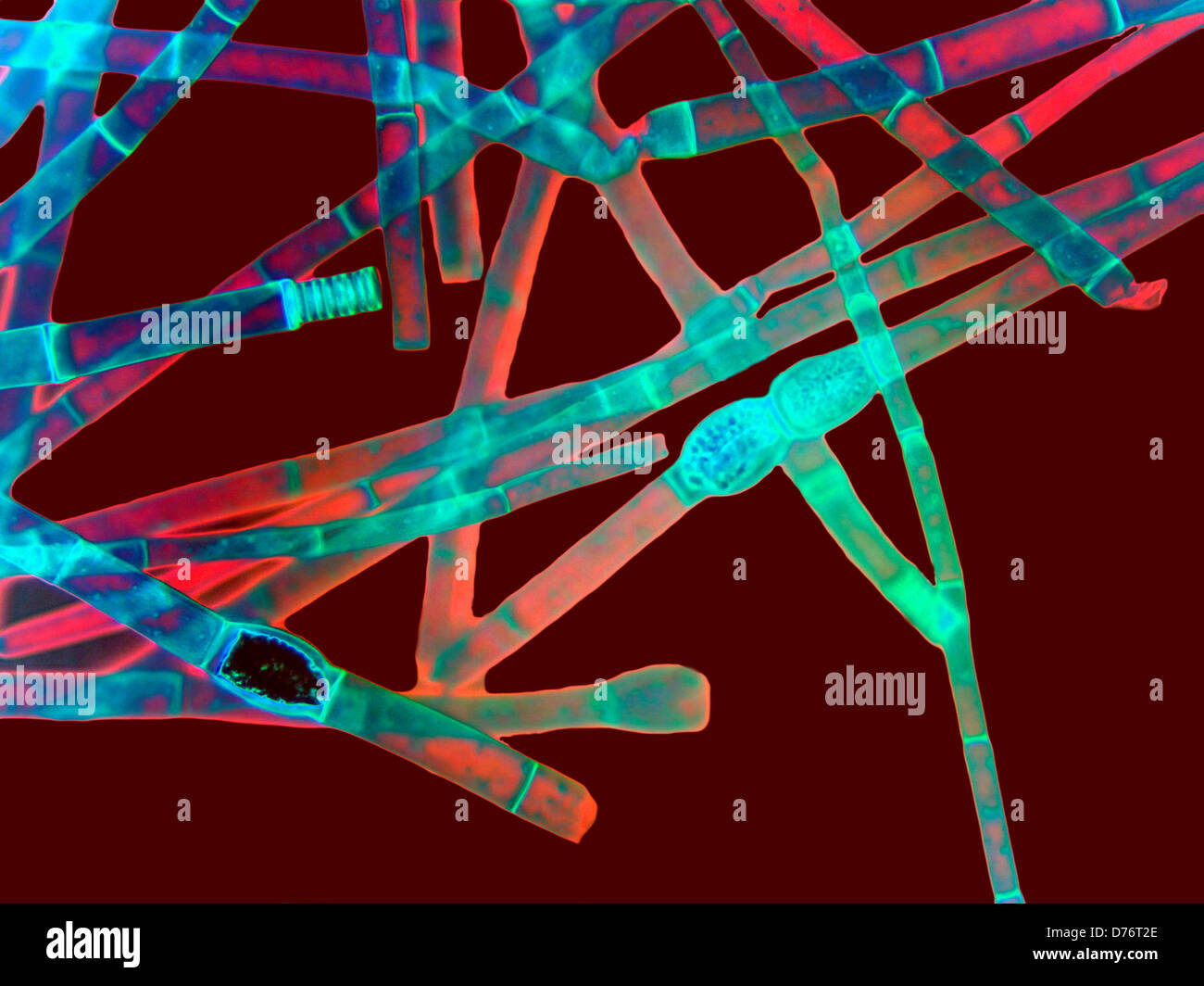 Microscopic view filamentous algae Oedogonium showing oogonium ...