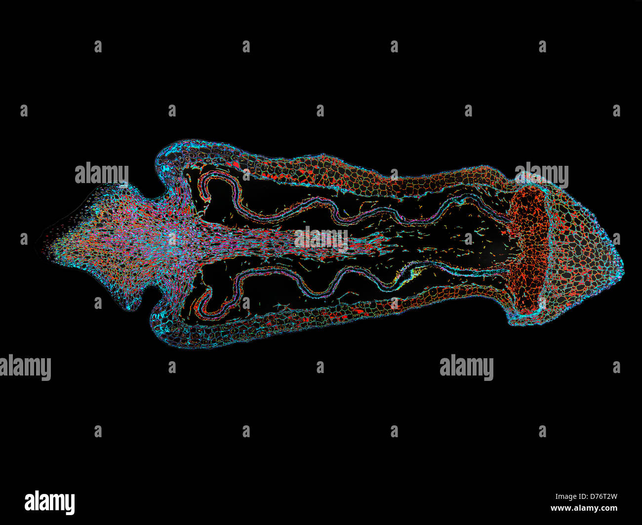 Moss immature capsule very detailed stained to show operculum spores ...