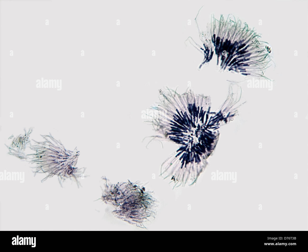 Clumps blue-green algae Cyanobacteria Rivularia stained permanent mount ...