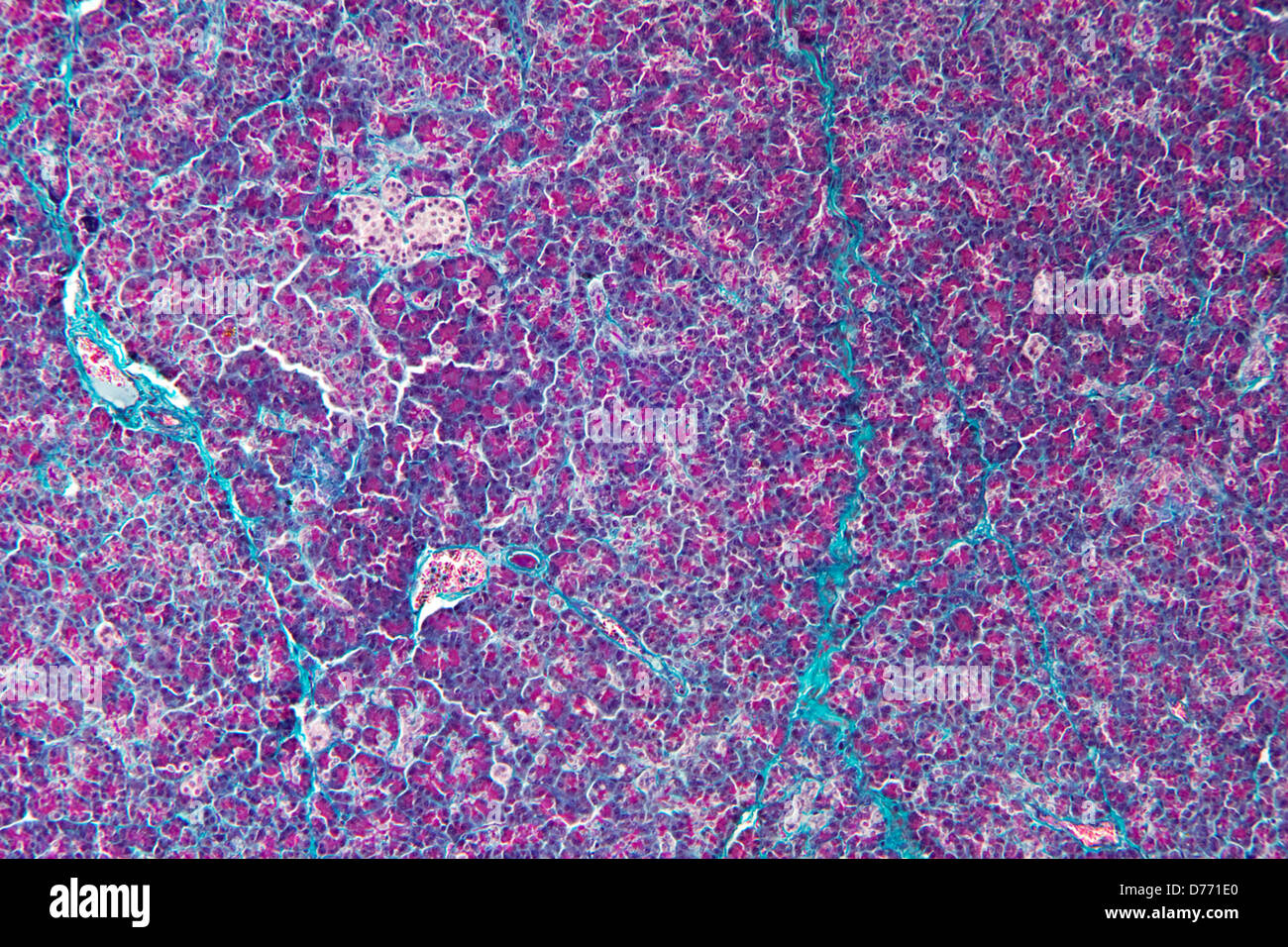 Human Histology section pancreas in light photomicrograph Stock Photo ...