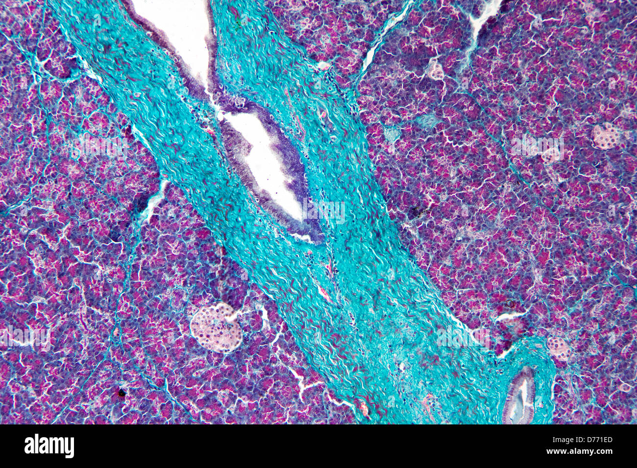 Human Histology section pancreas in light photomicrograph Stock Photo ...
