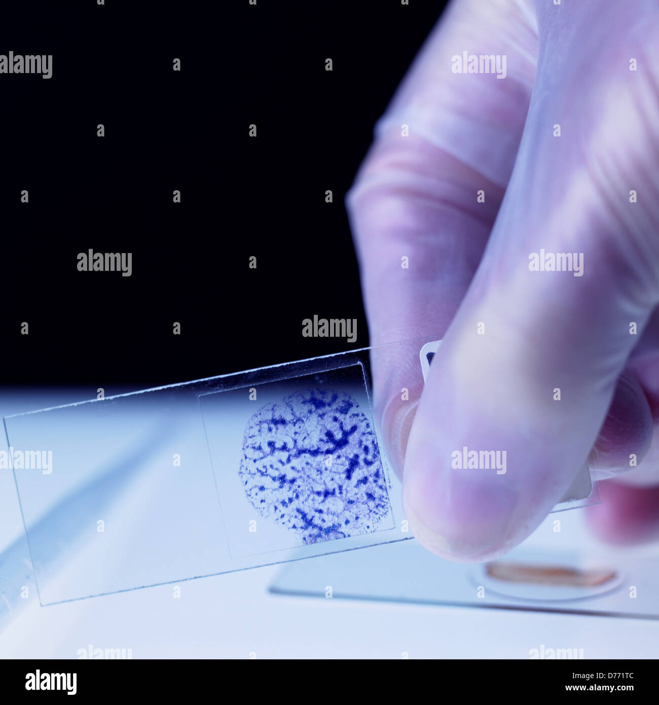 Microscope slide smear sample hi-res stock photography and images - Alamy