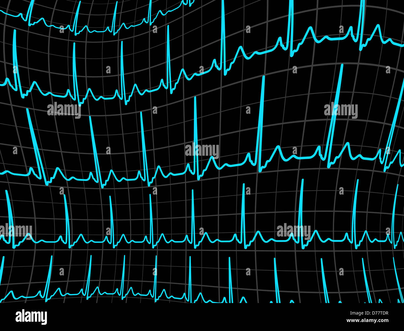 ECG tracing monitor Stock Photo - Alamy