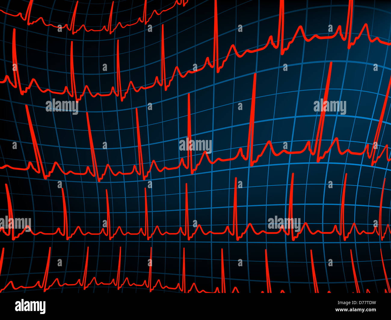 ECG tracing monitor Stock Photo - Alamy