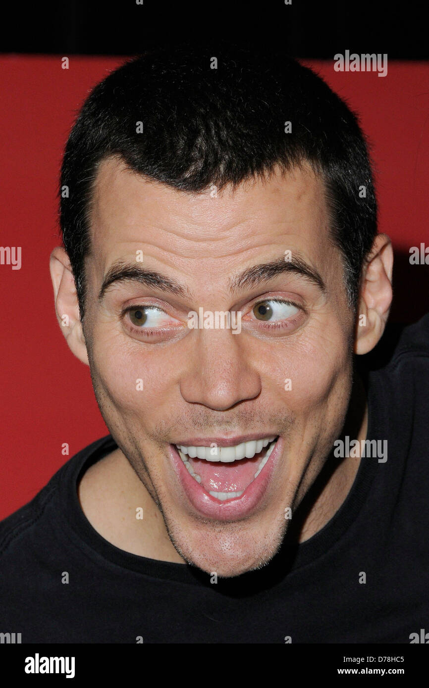 Steve O Before And After Teeth