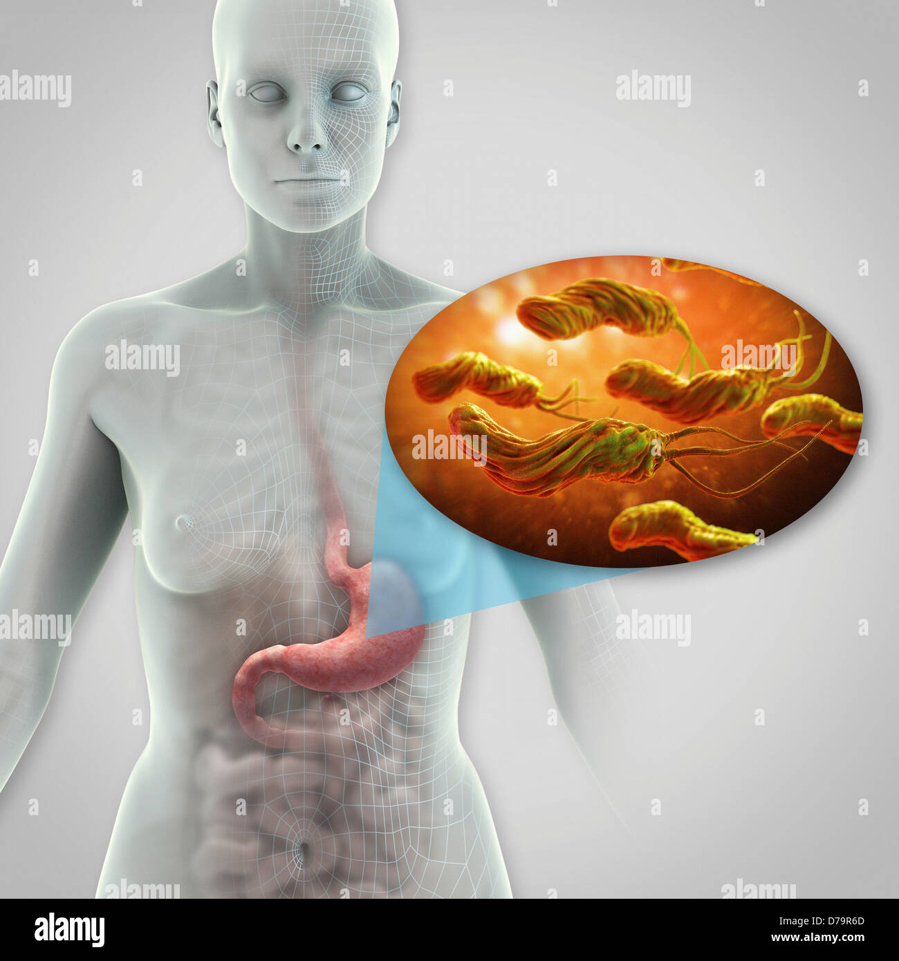 H. pylori stomach hi-res stock photography and images - Alamy