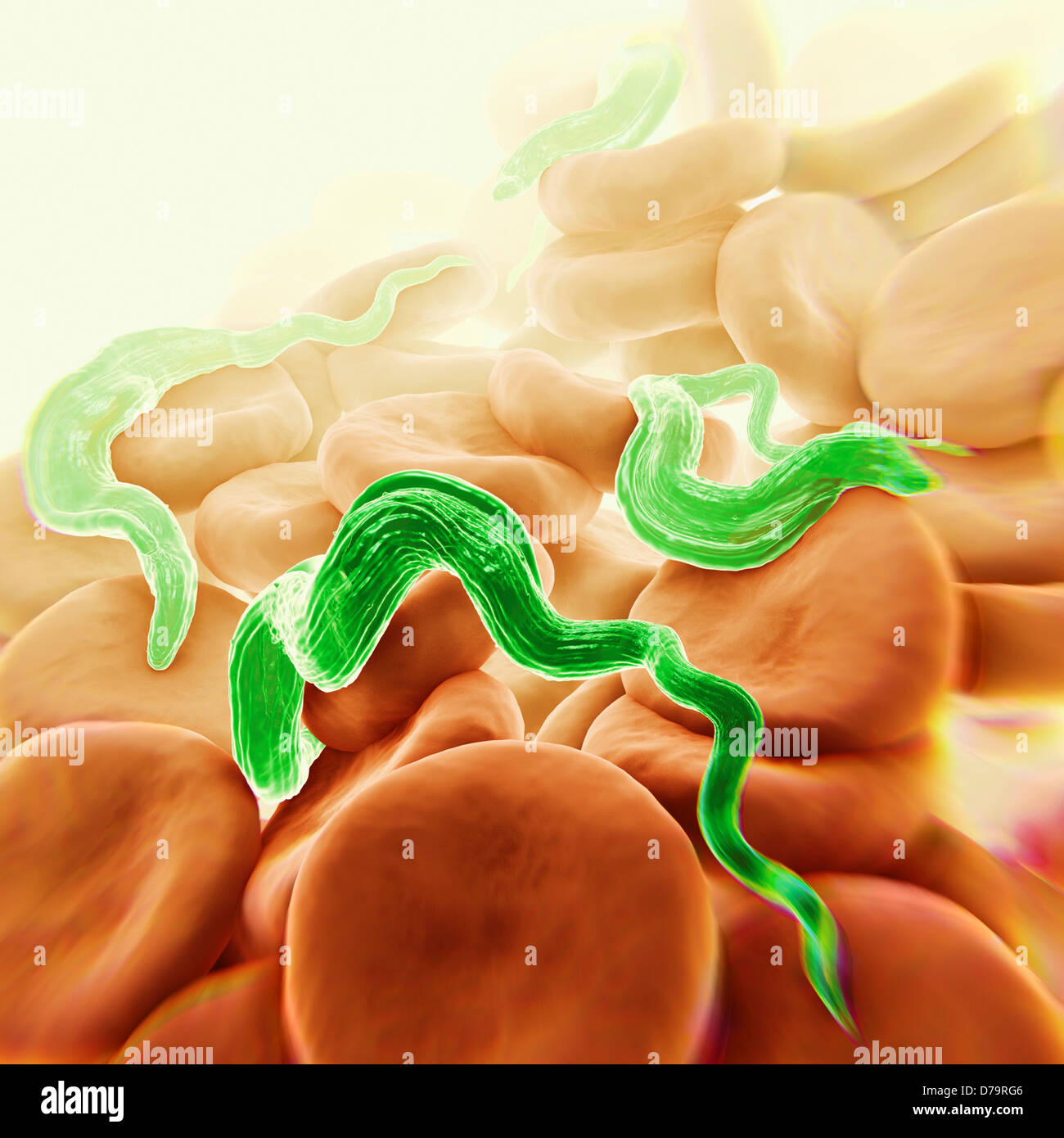Sleeping Sickness Infection Stock Photo - Alamy