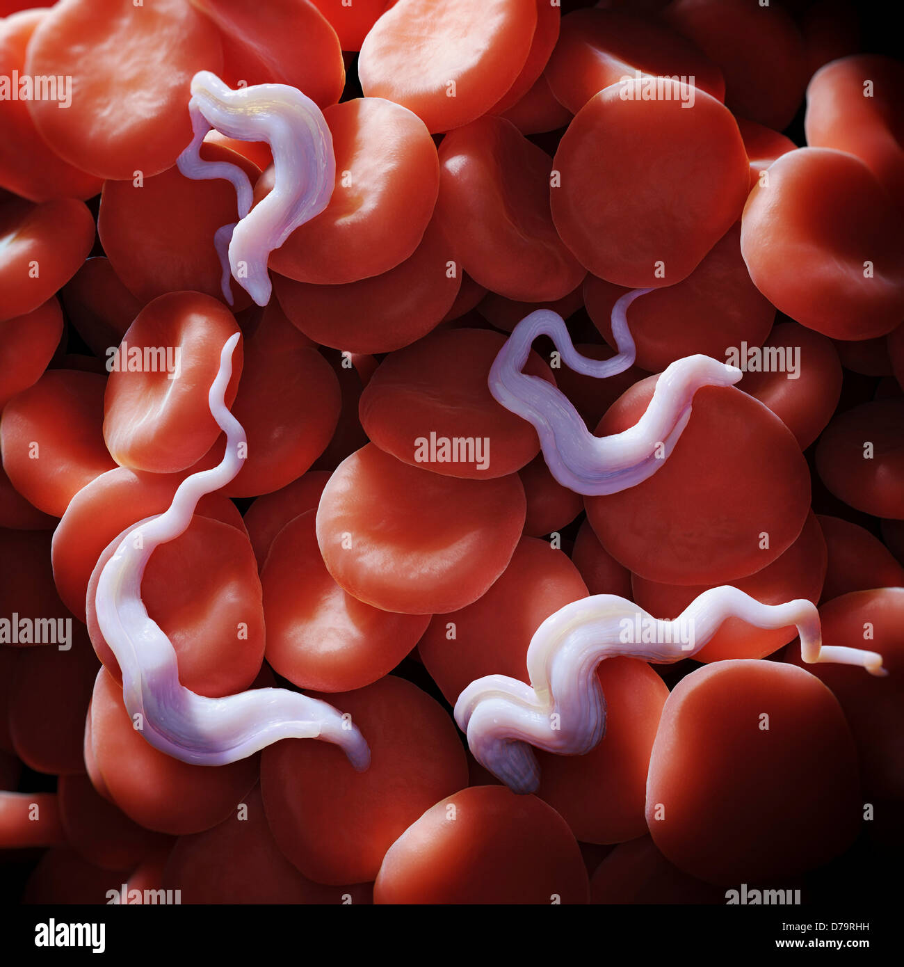 Sleeping Sickness Infection Stock Photo - Alamy