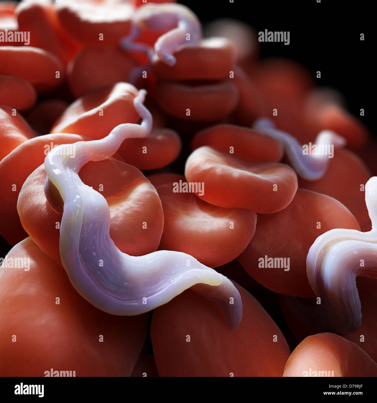 Sleeping Sickness Infection Stock Photo - Alamy