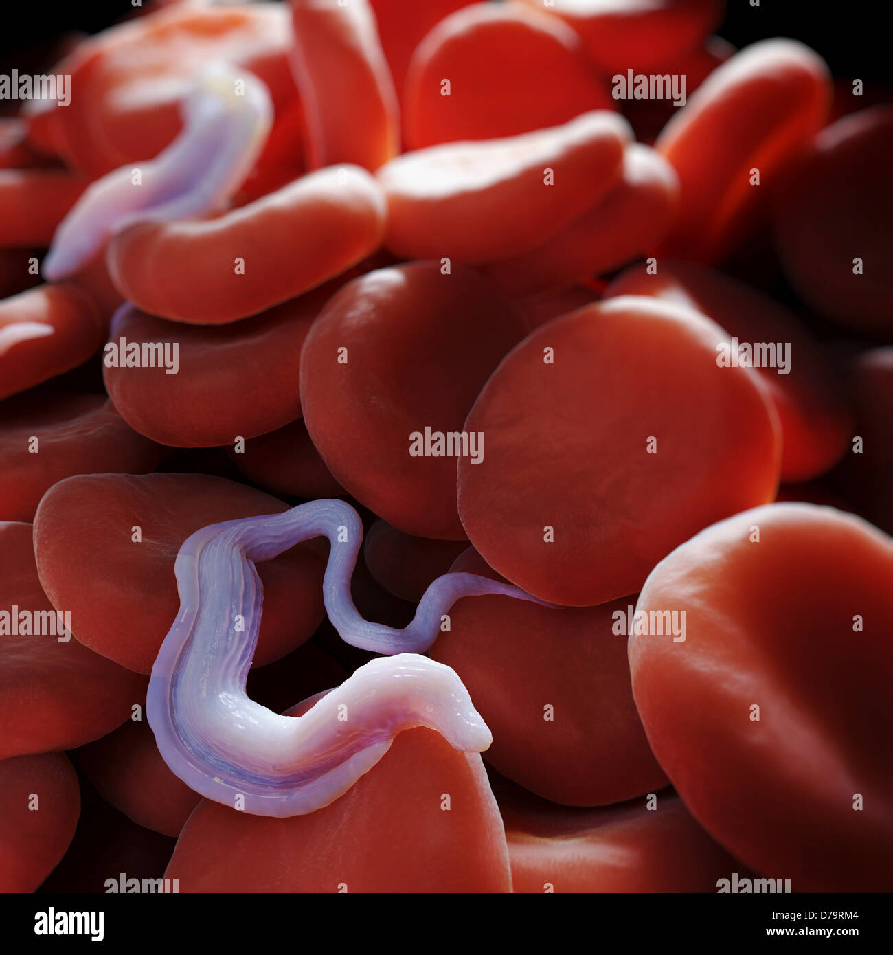 Sleeping Sickness Infection Stock Photo - Alamy