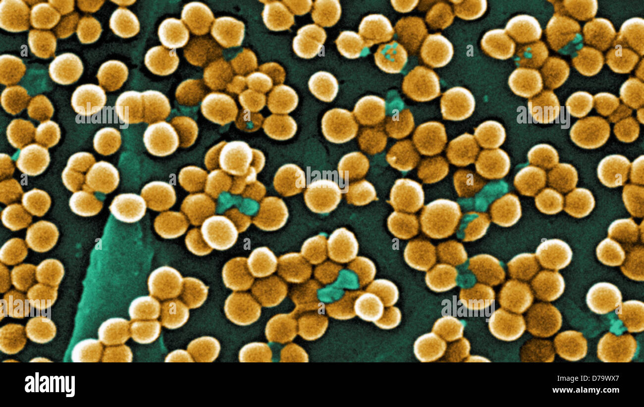 Scanning Electron Micrograph Mrsa Bacteria High Resolution Stock ...