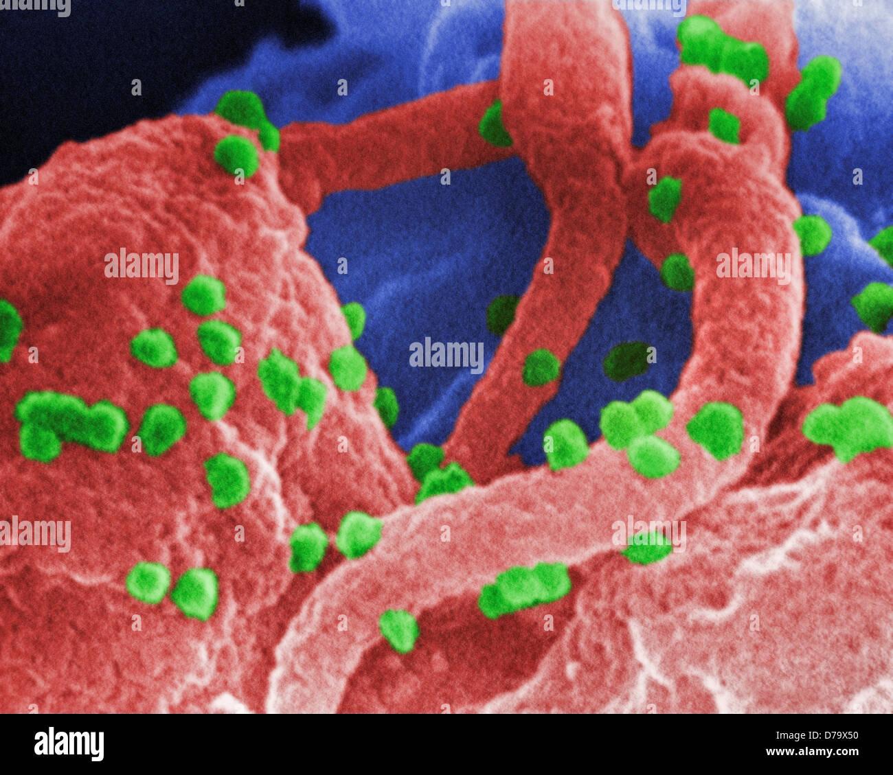 Scanning Electron Micrograph HIV Virions Stock Photo - Alamy