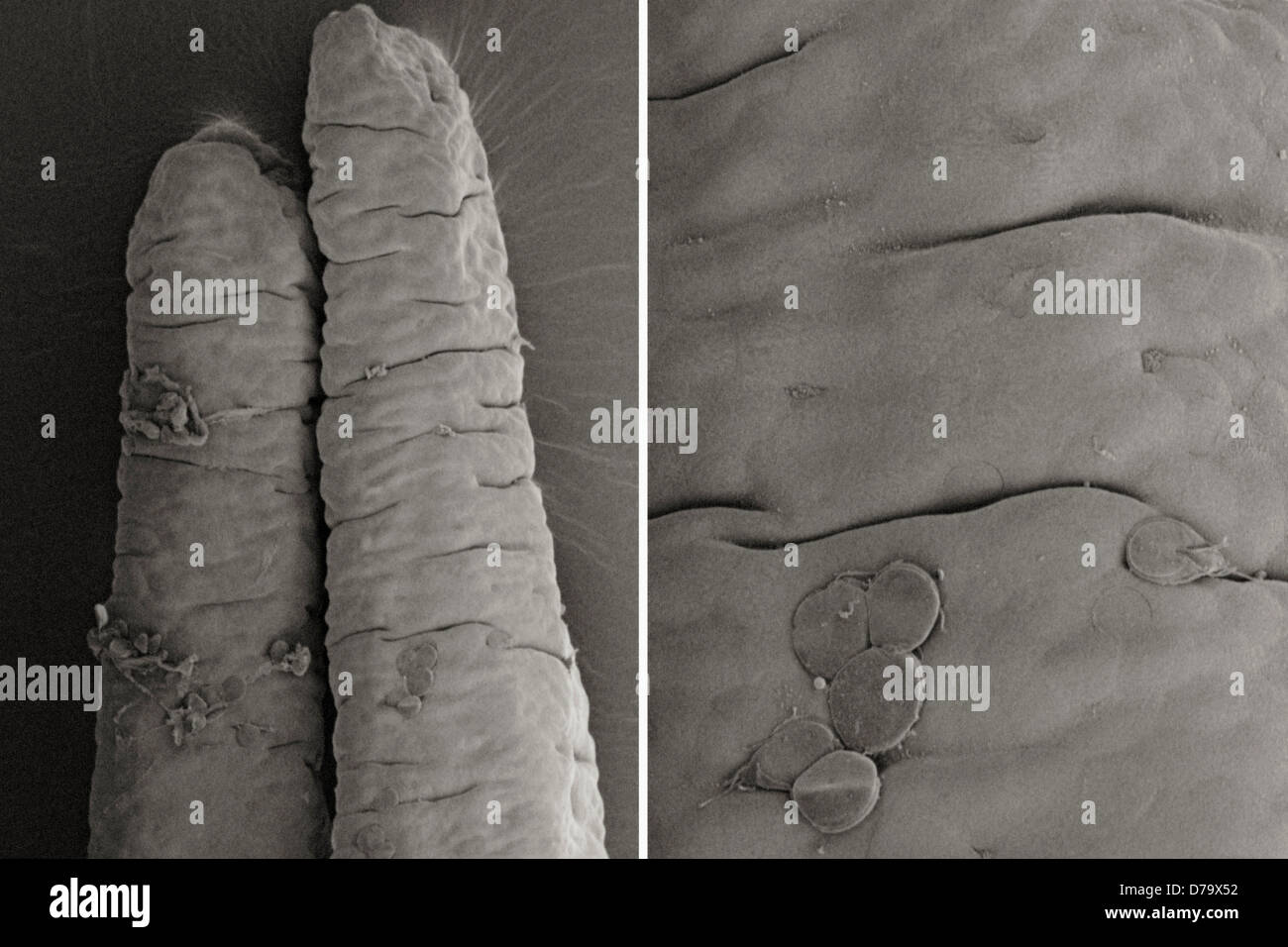 Scanning Electron Micrograph Rat's Intestine Giardia Stock Photo - Alamy