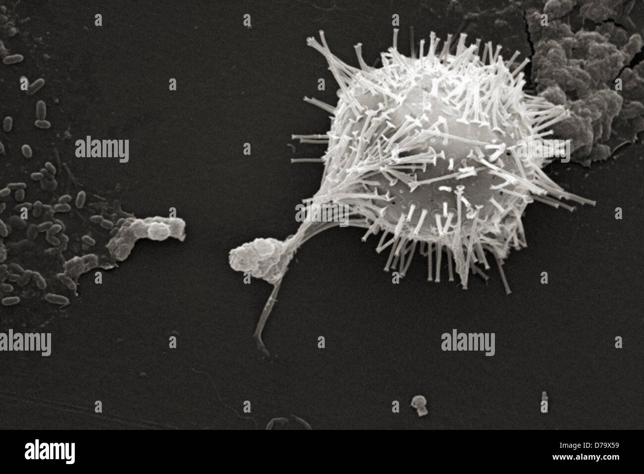 Electron micrograph hi-res stock photography and images - Alamy