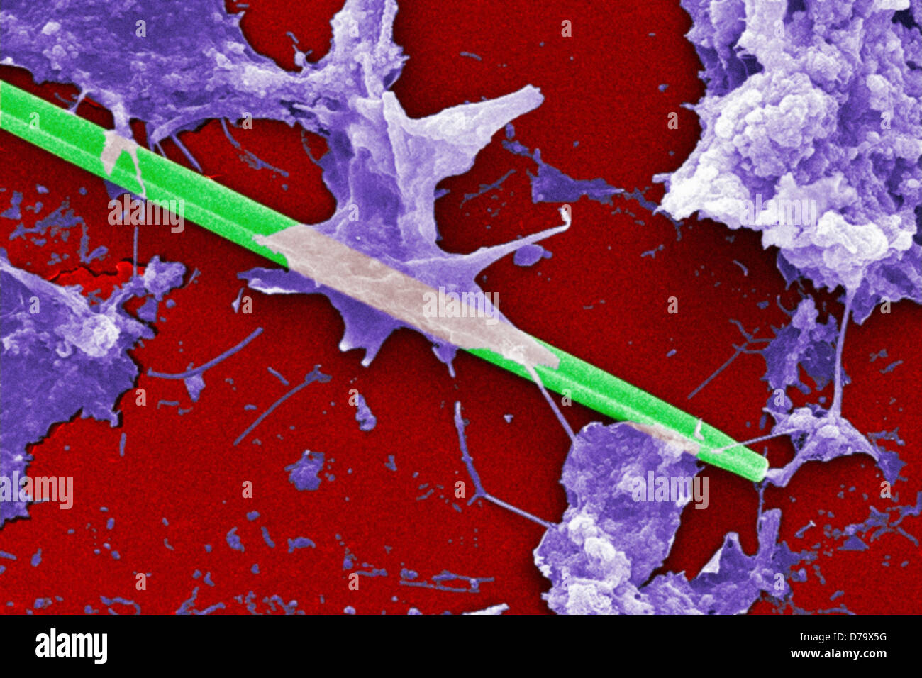 Scanning Electron Micrograph Untreated Water Sample Stock Photo - Alamy Scanning Electron Micrograph Untreated Water Sample Stock Photo - Alamy
