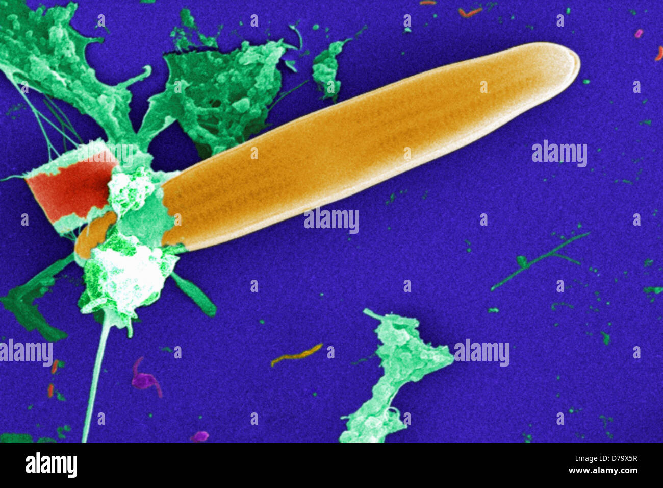 Scanning Electron Micrograph Untreated Water Sample Stock Photo - Alamy Scanning Electron Micrograph Untreated Water Sample Stock Photo - Alamy