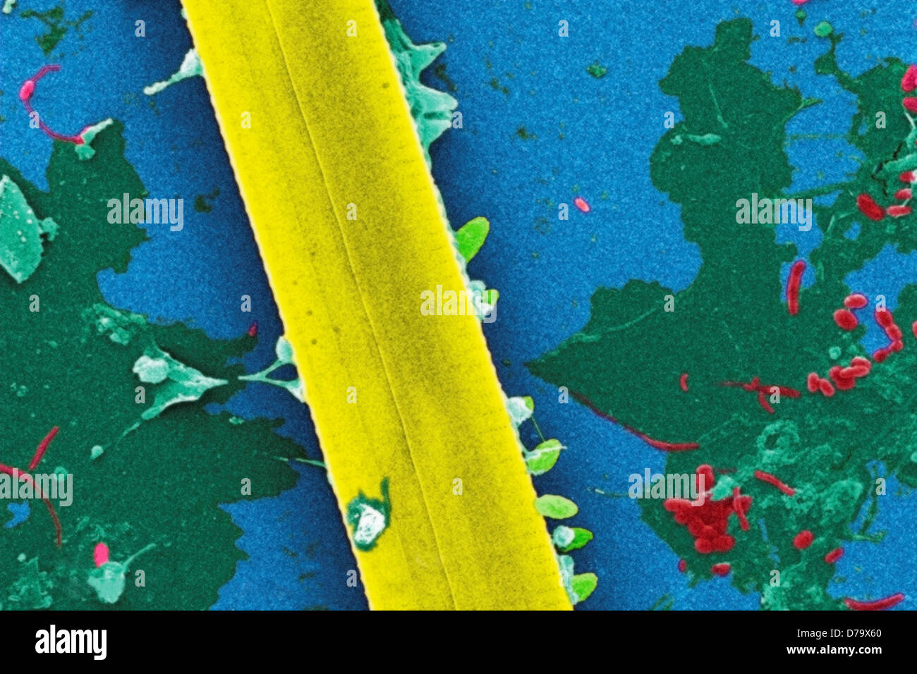 Scanning Electron Micrograph Untreated Water Sample Stock Photo - Alamy Scanning Electron Micrograph Untreated Water Sample Stock Photo - Alamy