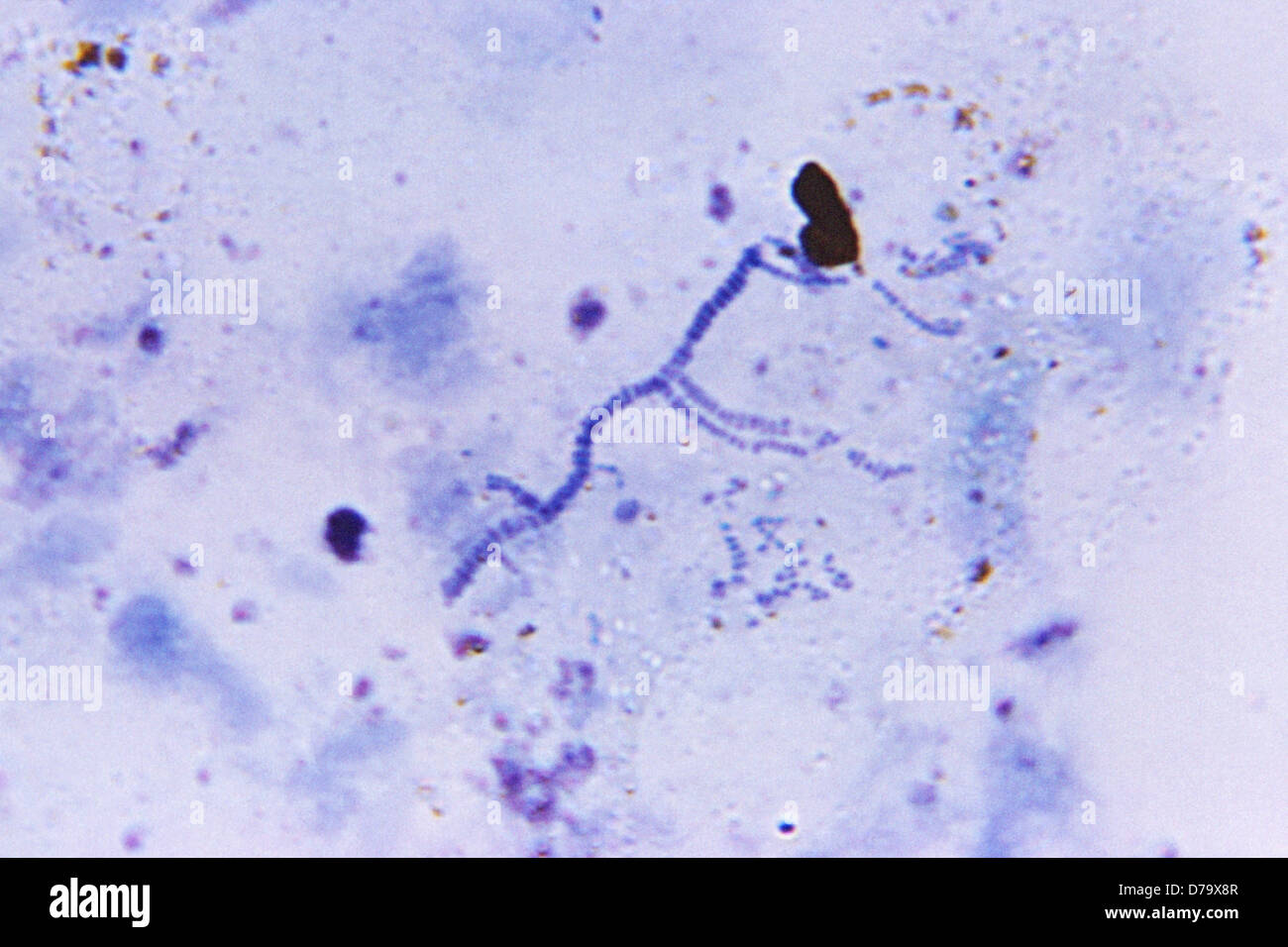 Dermatophilus congolensis Bacteria Stock Photo: 56151895 - Alamy