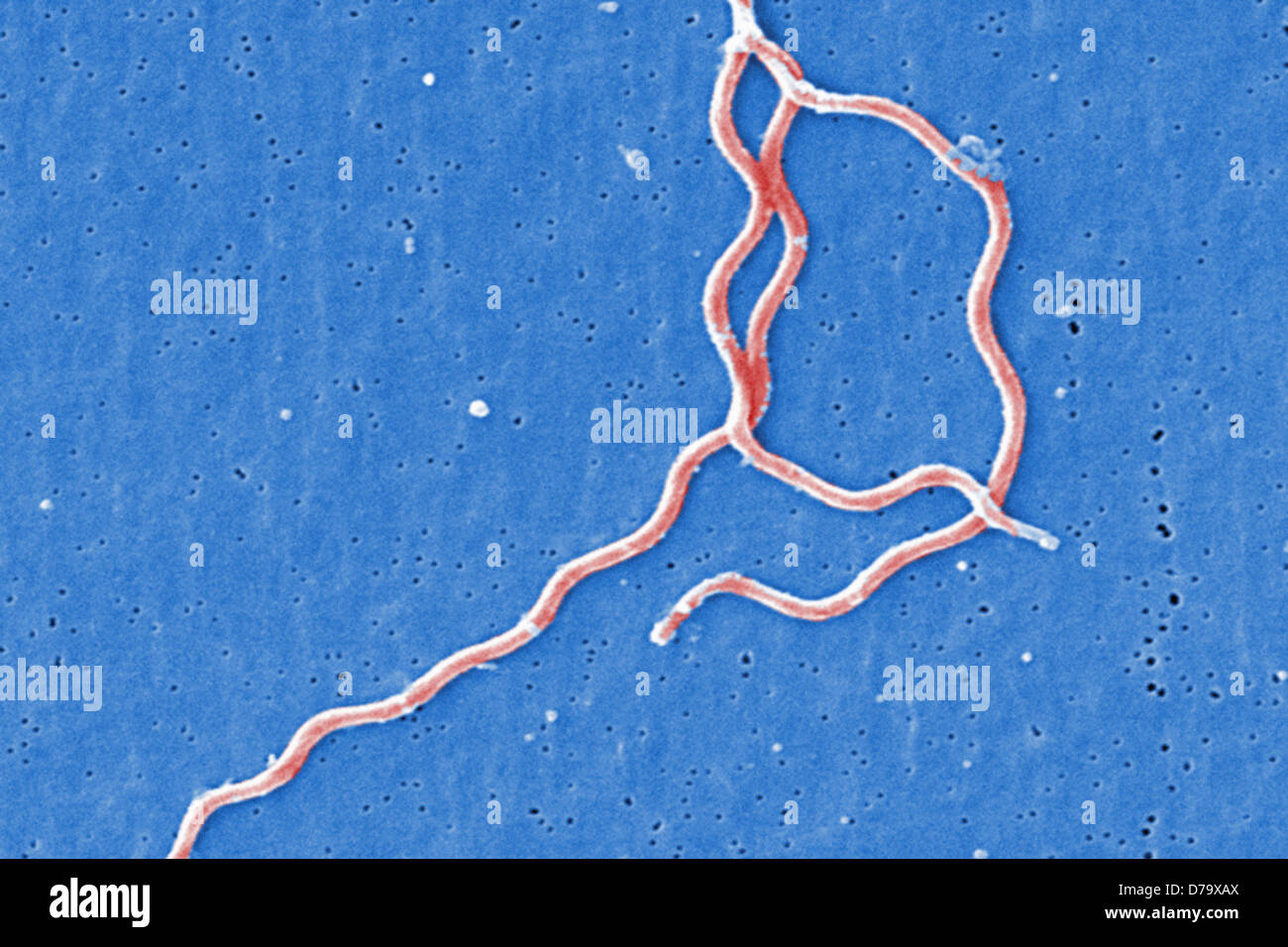 Scanning Electron Micrograph Borrelia burgdorferi Bacteria Stock Photo ...