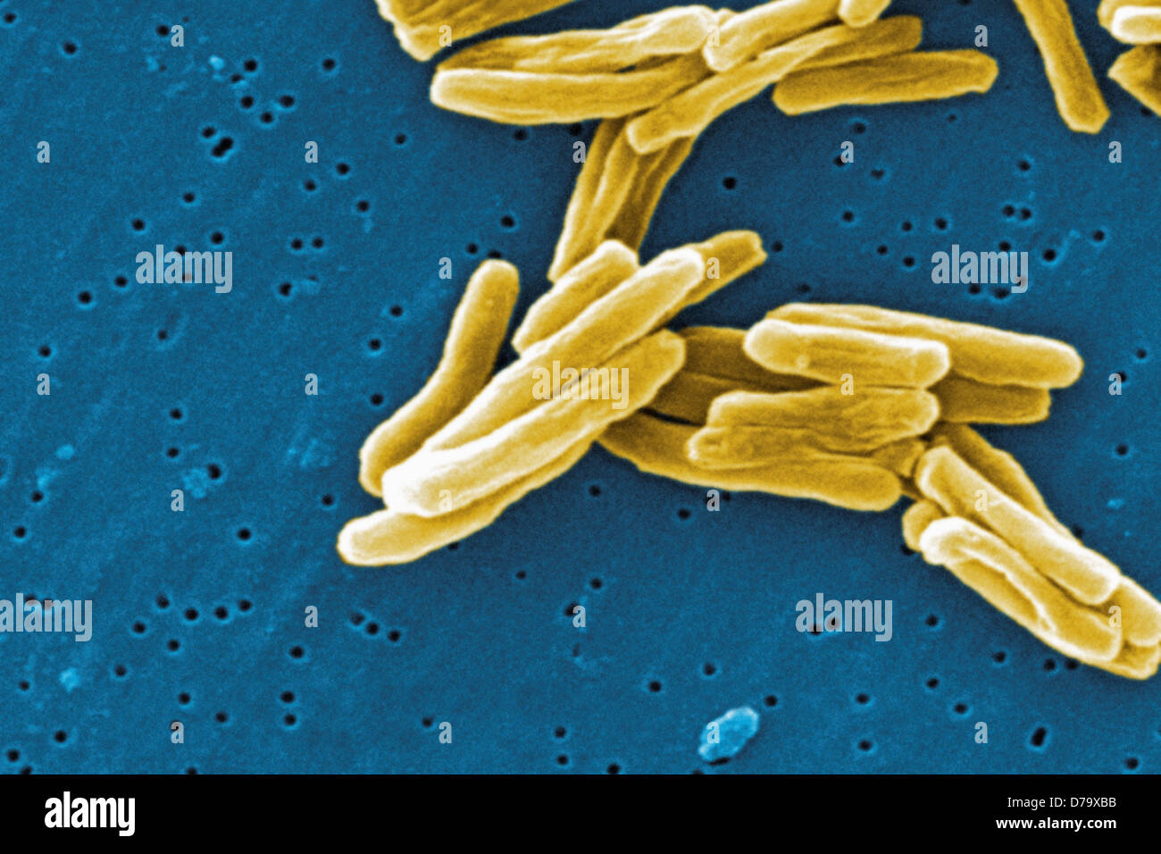 Mycobacterium tuberculosis bacteria hi-res stock photography and images - Alamy