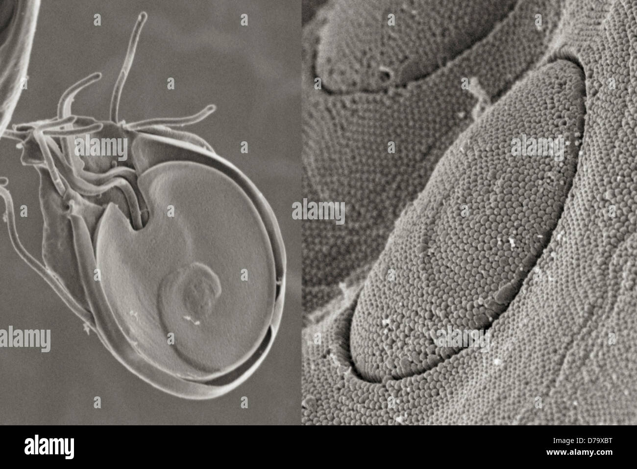 Giardia Protozoan's Ventral Adhesive Disk Circular Lesion Stock Photo ...