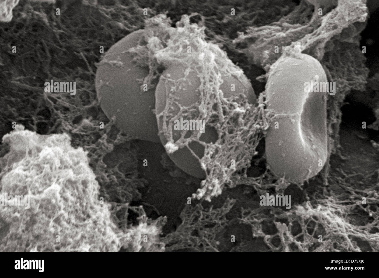Electron micrograph red blood cells hi-res stock photography and images ...