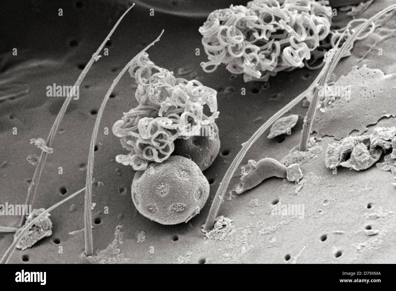 Microscopic debris hi-res stock photography and images - Alamy