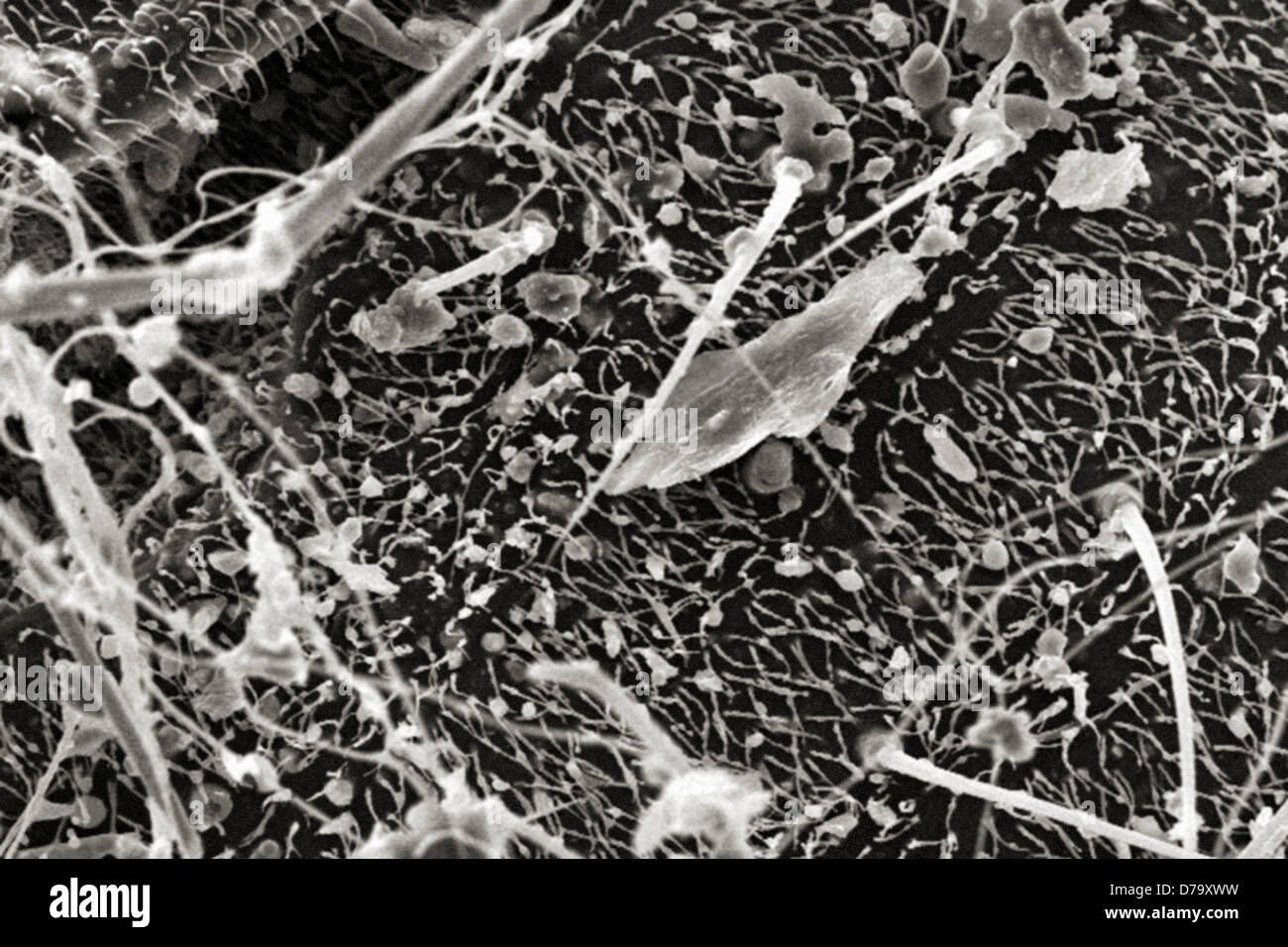 Microscopic Detail Dragonfly Exoskeleton Stock Photo - Alamy