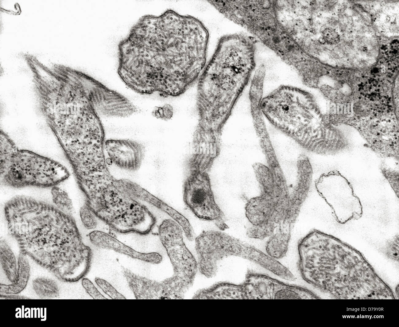 Cultured Mumps Virions Stock Photo - Alamy