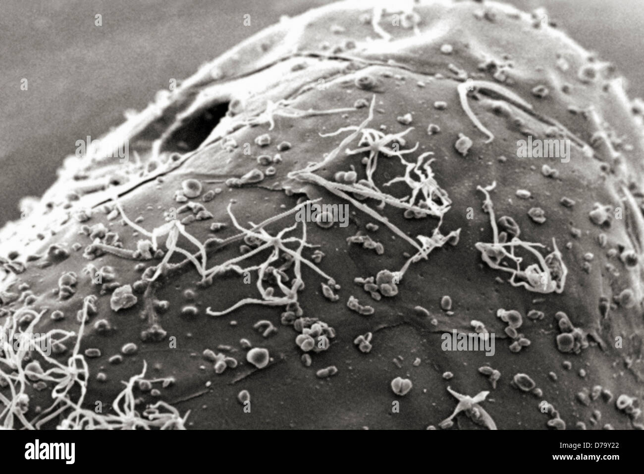 Microscopic Debris High Resolution Stock Photography and Images - Alamy