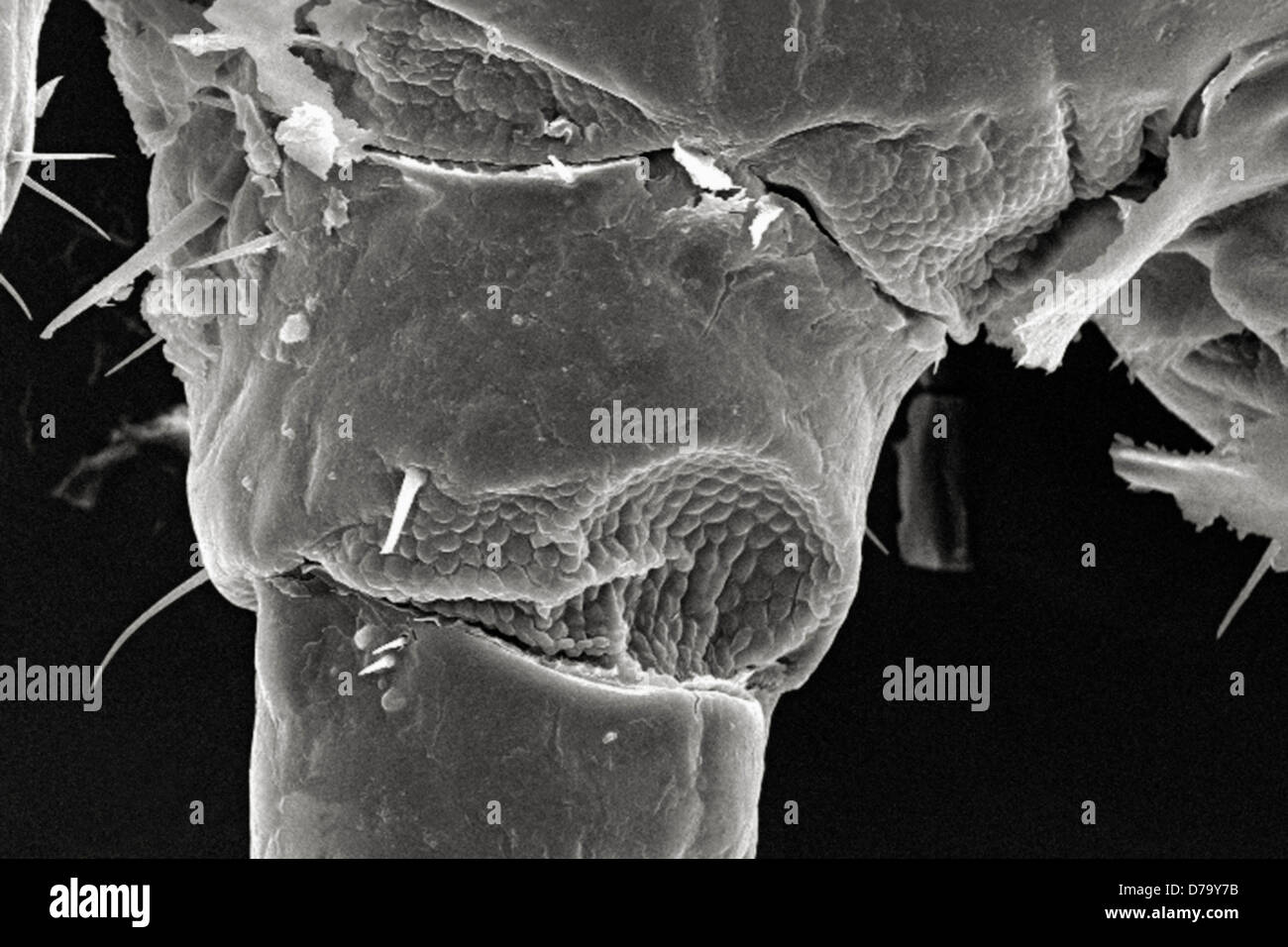 Microscopic Detail Body Louse's Leg Joint Stock Photo - Alamy