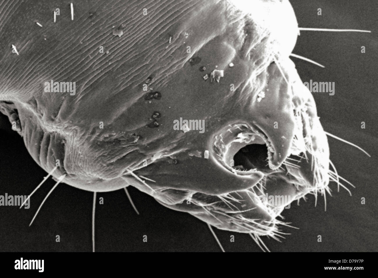 Microscopic Detail Female Body Louse Stock Photo - Alamy