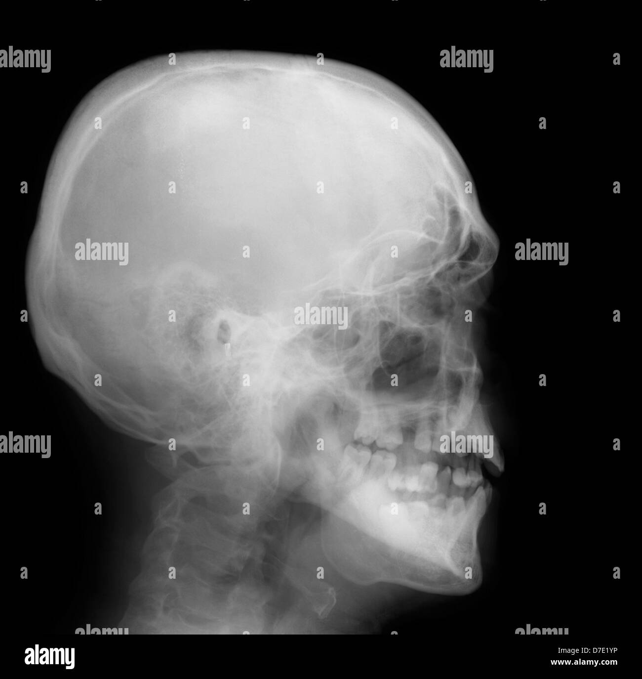 Scull bone hi-res stock photography and images - Alamy