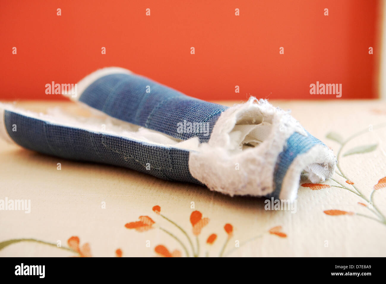 Empty child's cast that has been removed from arm Stock Photo - Alamy