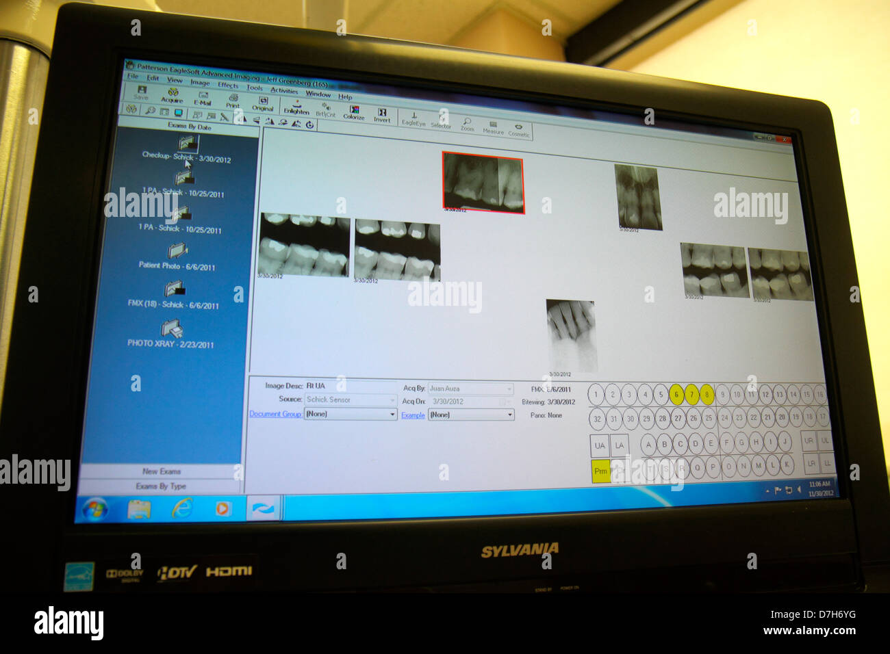 Miami Beach Florida,dentist office,computer monitor,screen,x ray,teeth ...