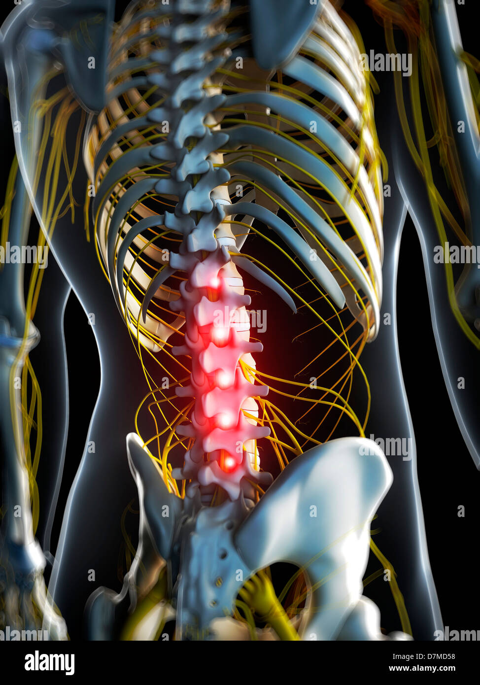 Back pain, conceptual artwork Stock Photo - Alamy