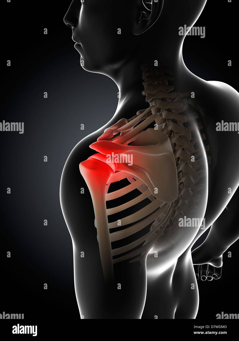 Shoulder blade pain hi-res stock photography and images - Alamy