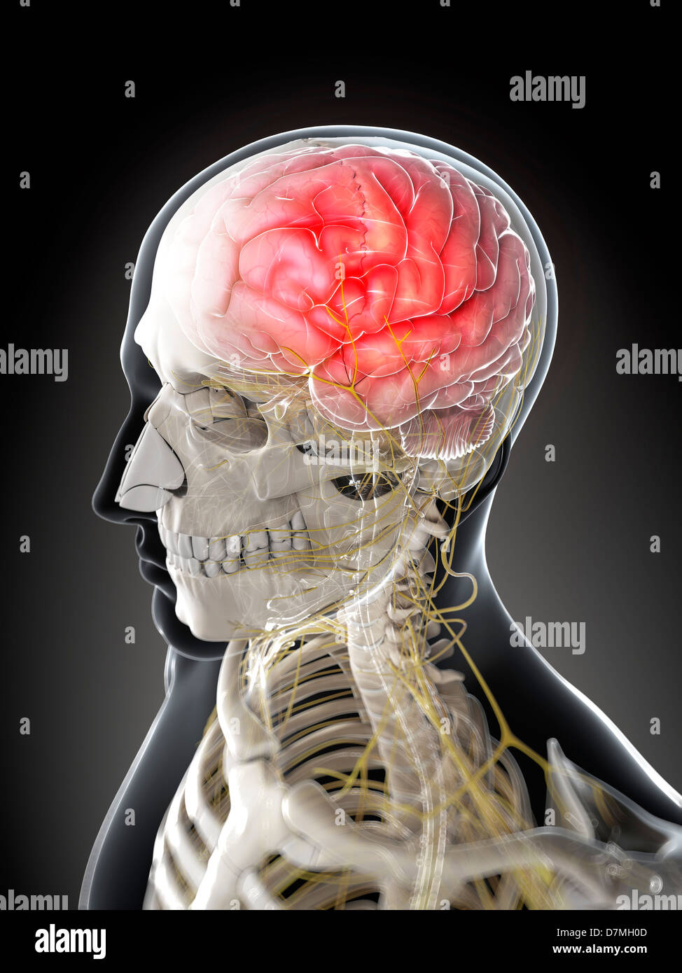 Shoulders headache high hi-res stock photography and images - Alamy