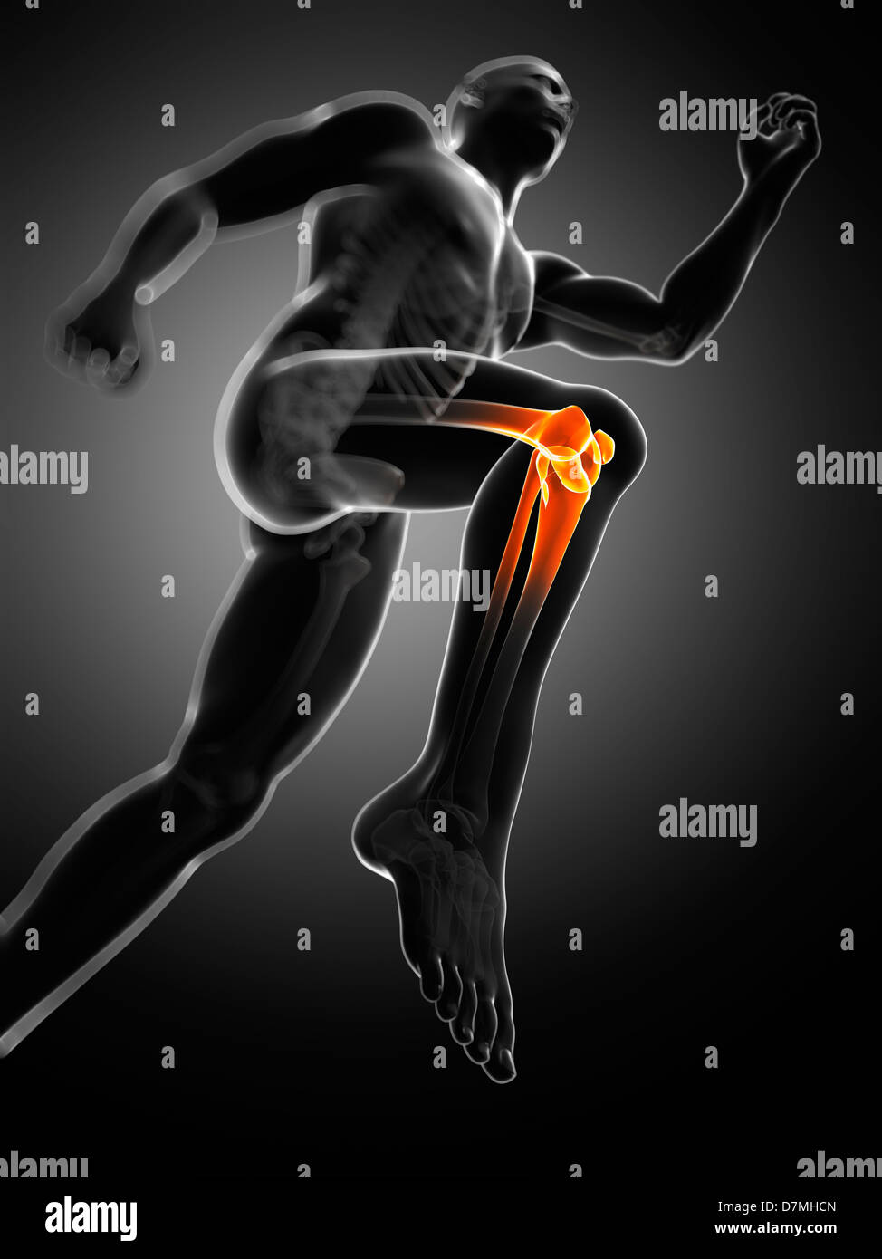 Knee pain, conceptual artwork Stock Photo - Alamy